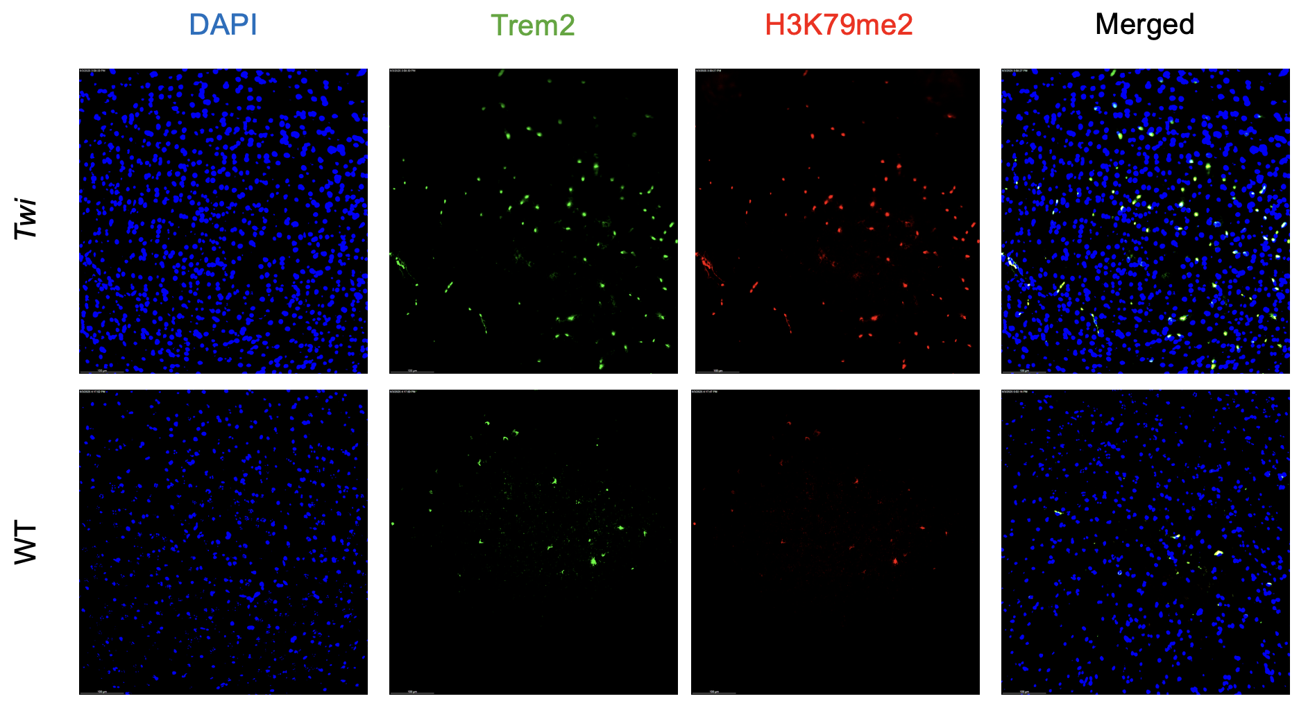 Contribution of DOT1L to Neuropathology in Krabbe Disease | Glial ...
